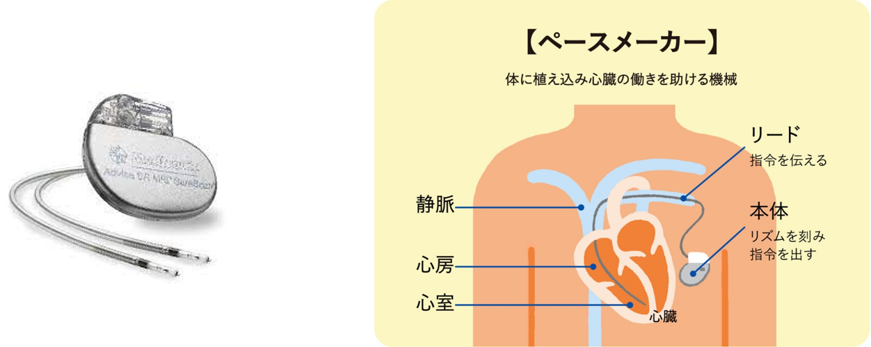Arrhythmia - 聖路加国際病院 心血管センター